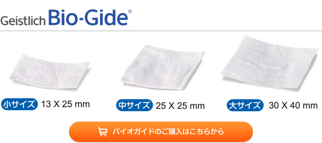 Geistlich Bio-Oss（ガイストリッヒ バイオオス） Geistlich Bio-Gide（ガイストリッヒ バイオガイド ...